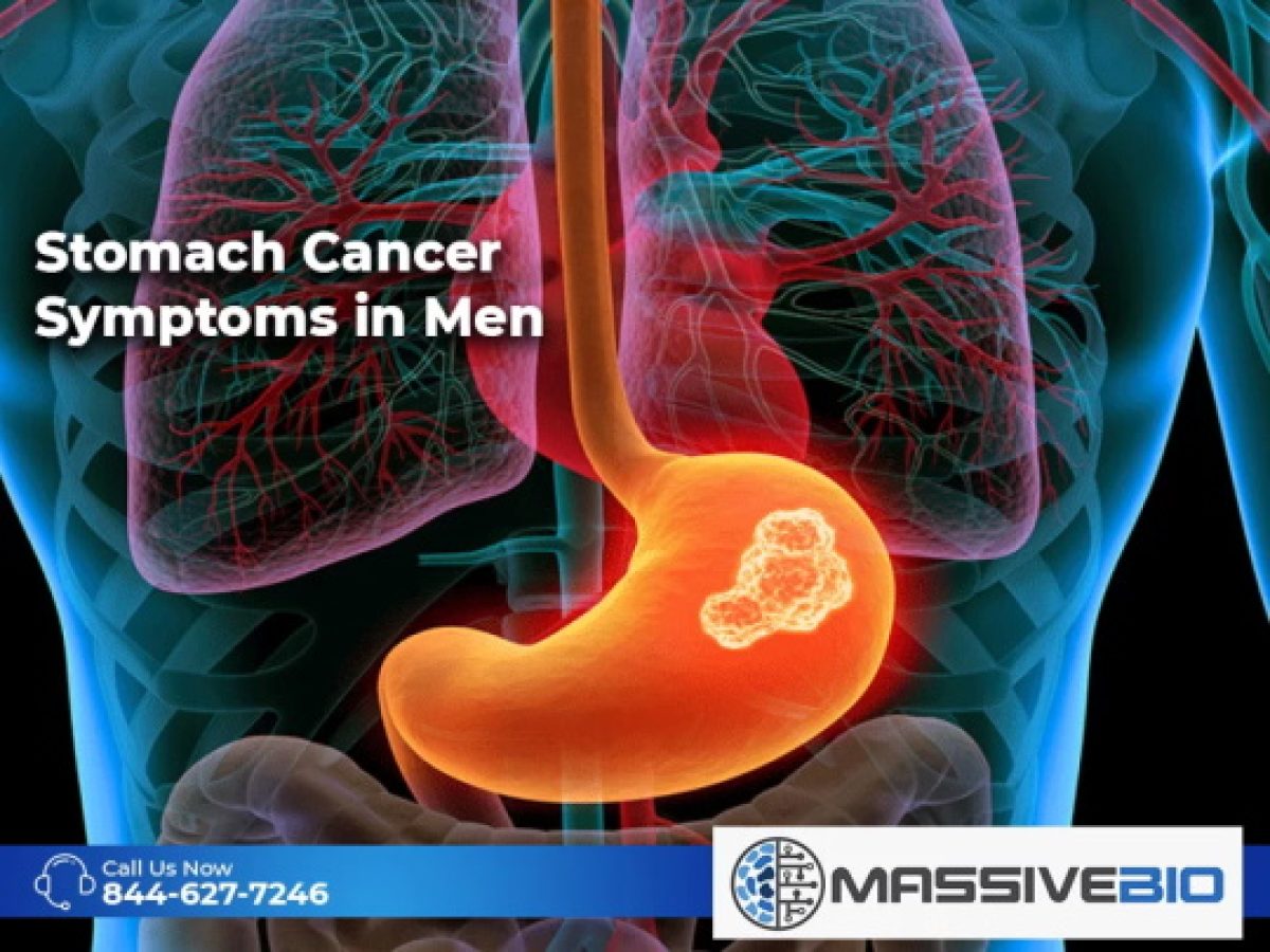 Early Stage Stomach Cancer Symptoms How Stomach Cancer Is Diagnosed