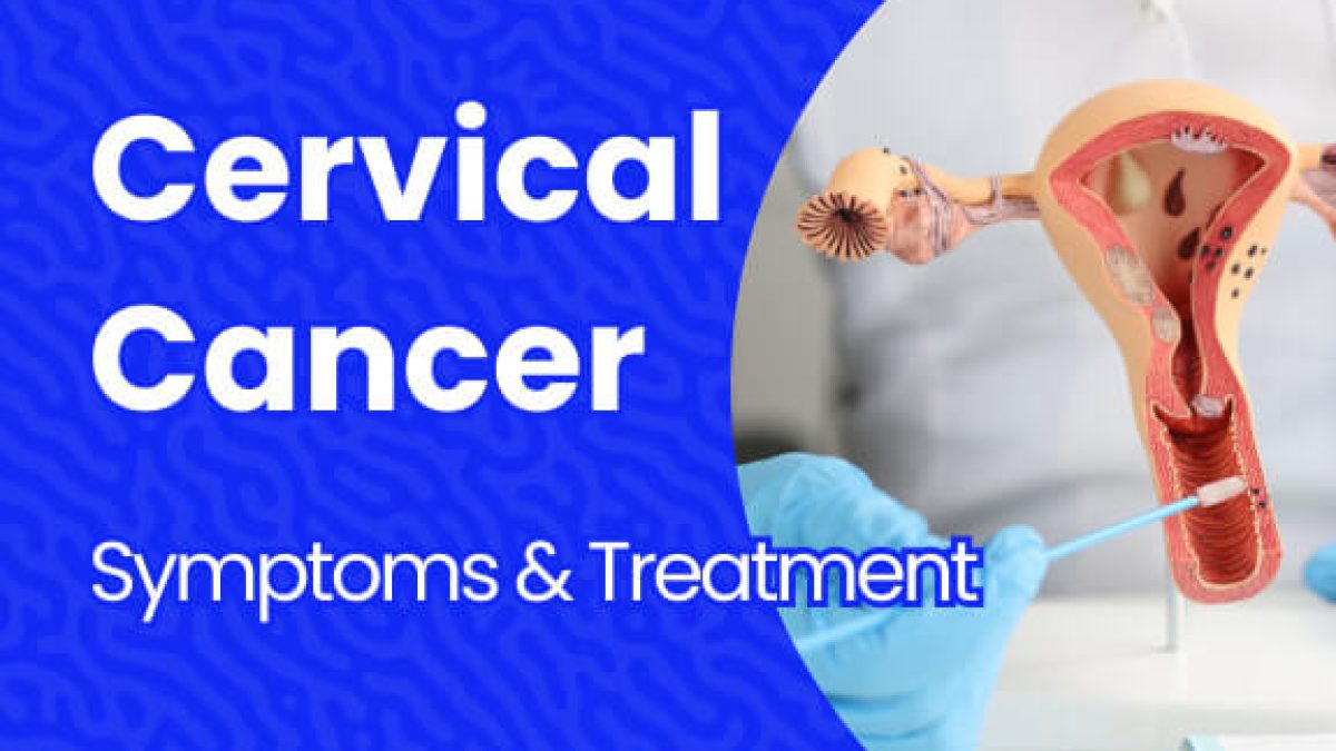 What Causes Cervical Cancer Cervical Cancer Symptoms And Causes | City