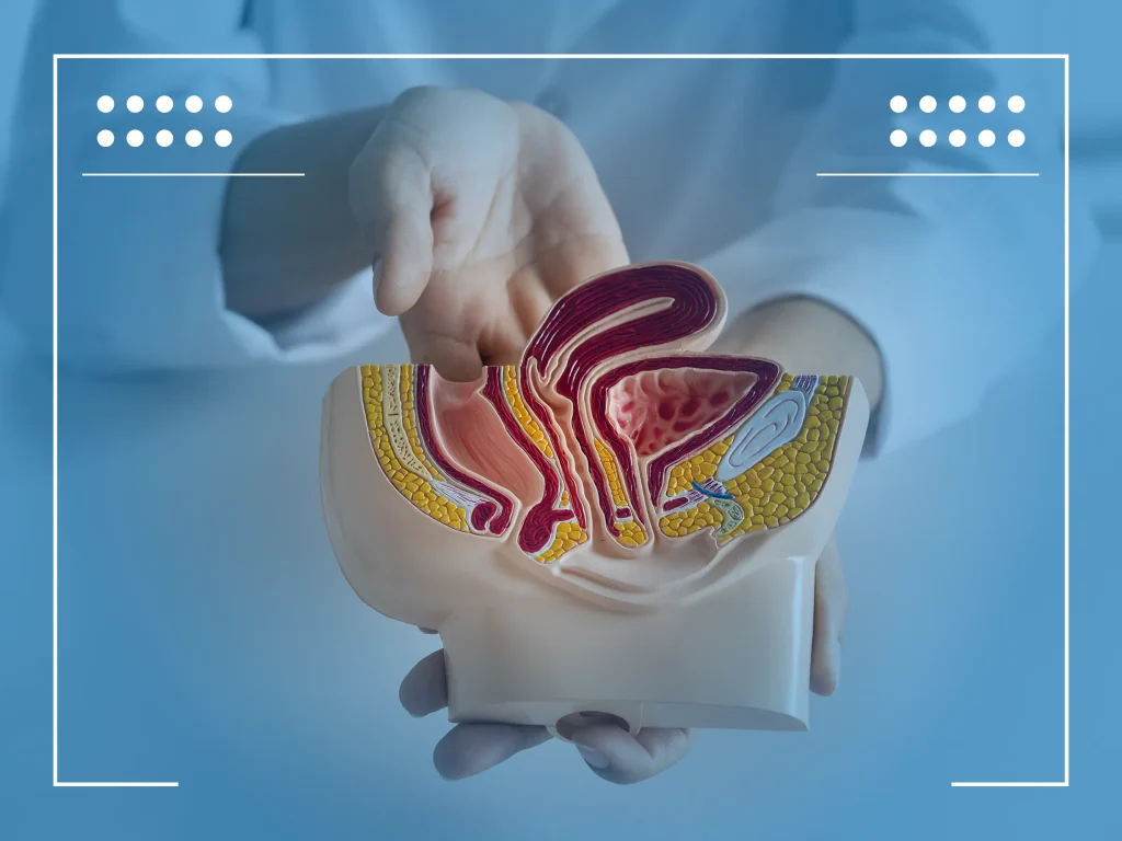Bladder Cancer ICD 10 What Is The ICD 10 Code For Bladder Cancer Bladder Cancer ICD 10 What Is The ICD 10 Code For Bladder Cancer