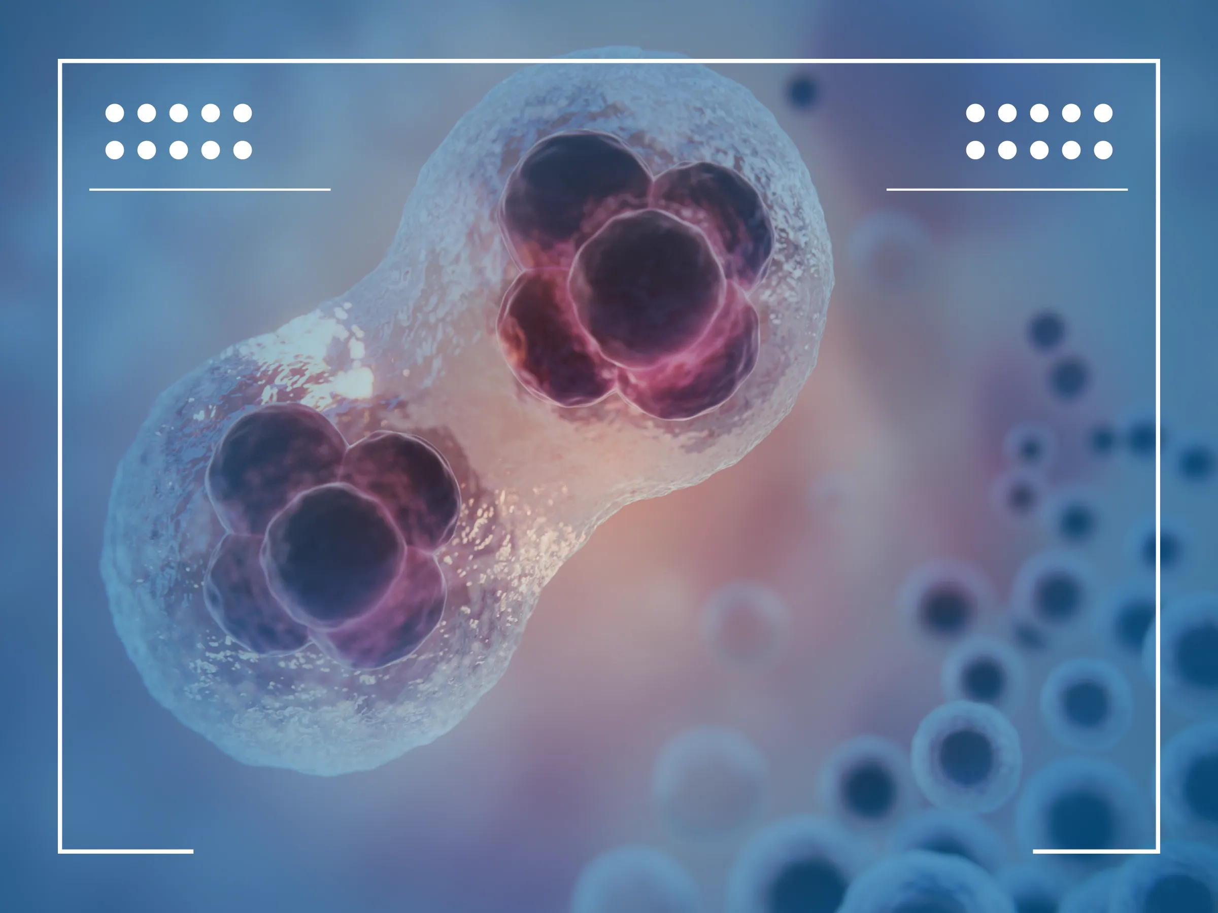 Μετάσταση καρκίνου - Μετασταση Καρκινου Στους Λεμφαδενες